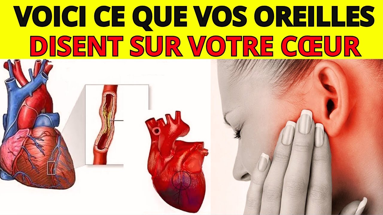 Voici ce que vos oreilles disent sur votre cœur Maladies que vos ...