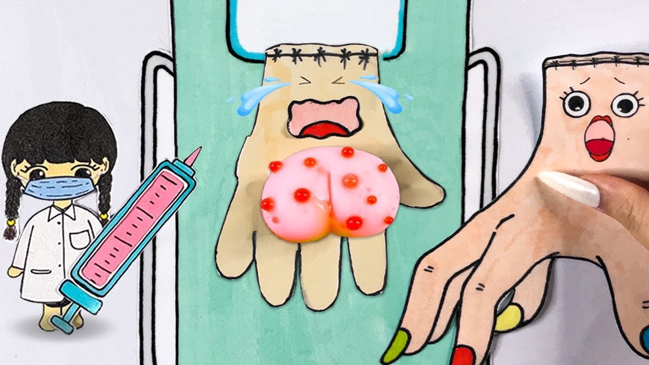 [🐾paper diy🐾] POP THE PIMPLES #2 👶👶 Baby Wednesday care tips 놀이 종이 ...