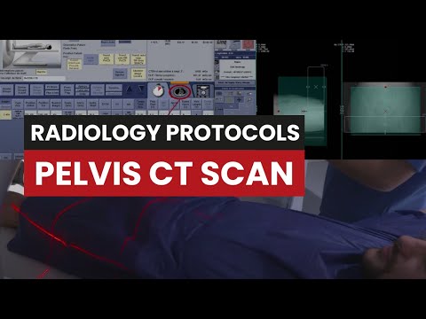 CT Scan of the Pelvis A Protocol Guide for Radiology Techs - YouTube