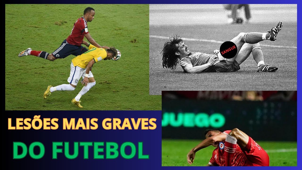 TOP 5 LESÕES MAIS GRAVES DA HÍSTORIA DO FUTEBOL - YouTube