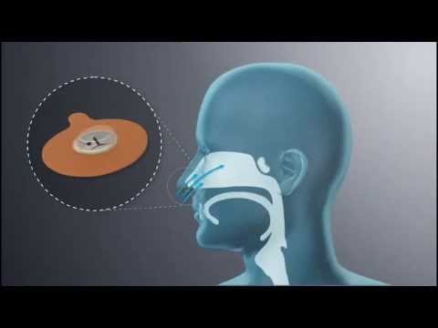 What is Provent Sleep Apnea Therapy & How Does it Work? - YouTube