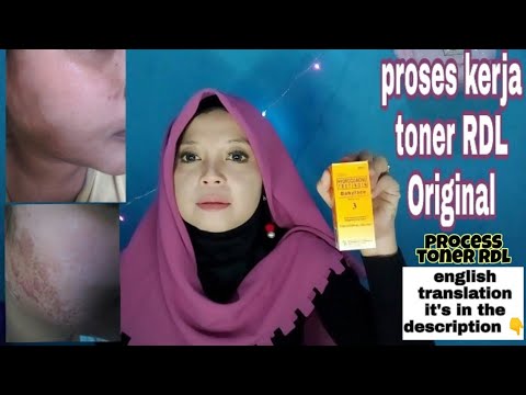 TONER RDL ORIGINAL | PROSES DARI AWAL PAKE SAMPE AKHIR YANG MAXIMAL ...
