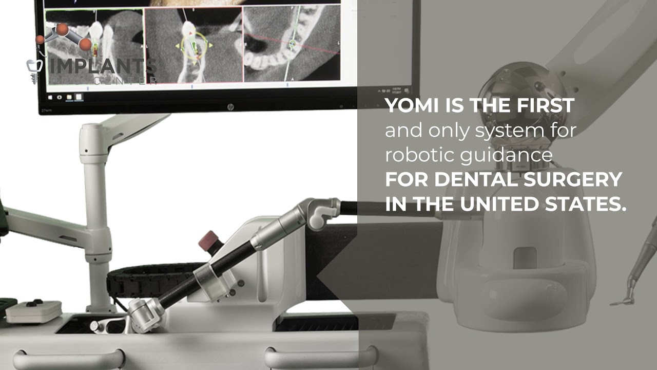 Robotic Assistance in Dentistry | YOMI | Robot Assisted Minimally ...