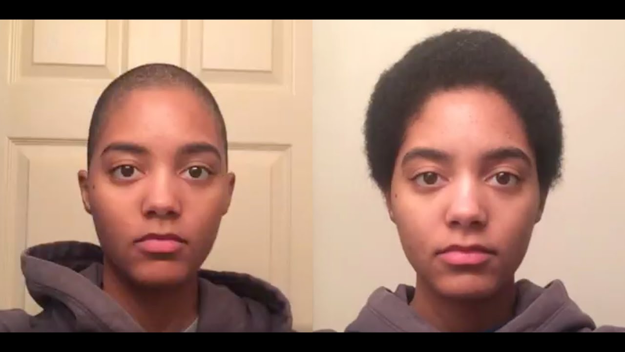 4+ Hair Growth Time Lapse - YouTube