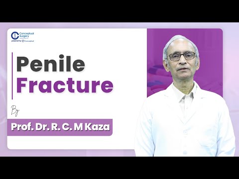 Penile Fracture: Diagnosis, Anatomy & Management Simplified | Prof. Dr. R. C. M Kaza