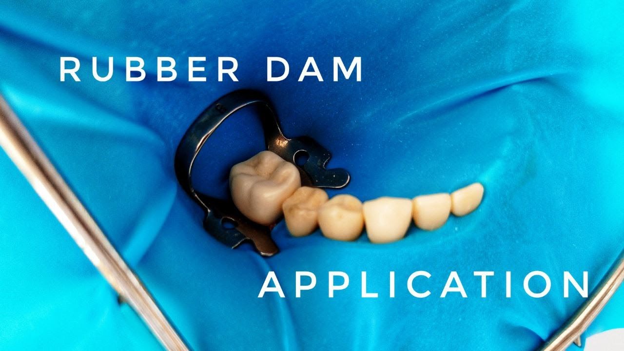 Rubber Dam Application - YouTube