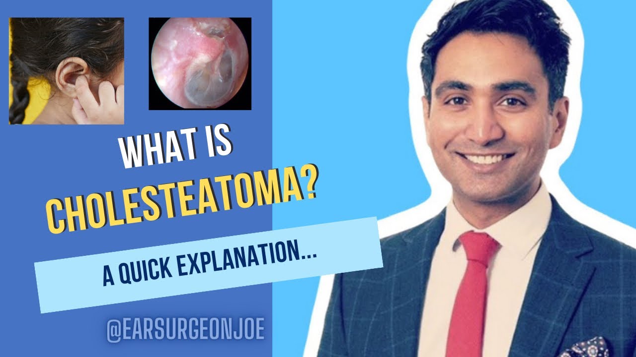 What is Cholesteatoma? - an ear surgeon explains - YouTube