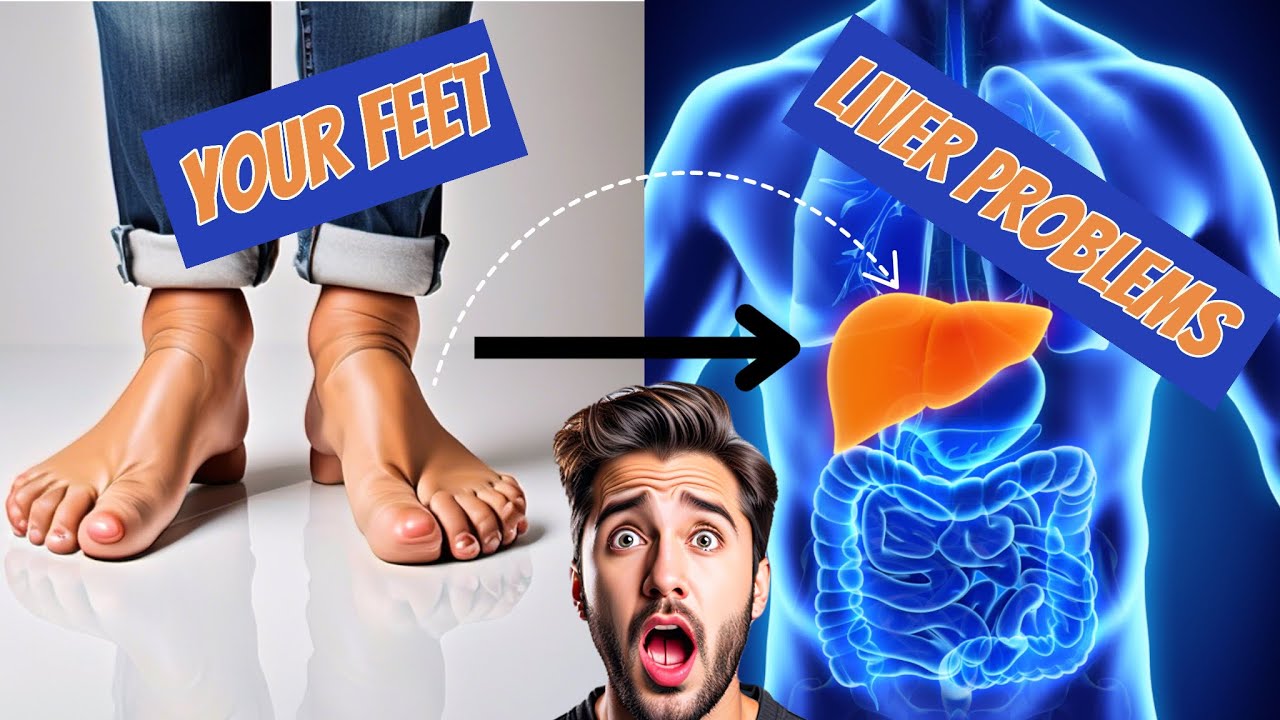 HOW YOUR FEET ARE WARNING YOU ABOUT YOUR LIVER PROBLEMS !!! 🦶😨 - YouTube
