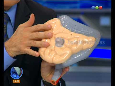 Qué es la Escherichia Coli  - Telefe Noticias