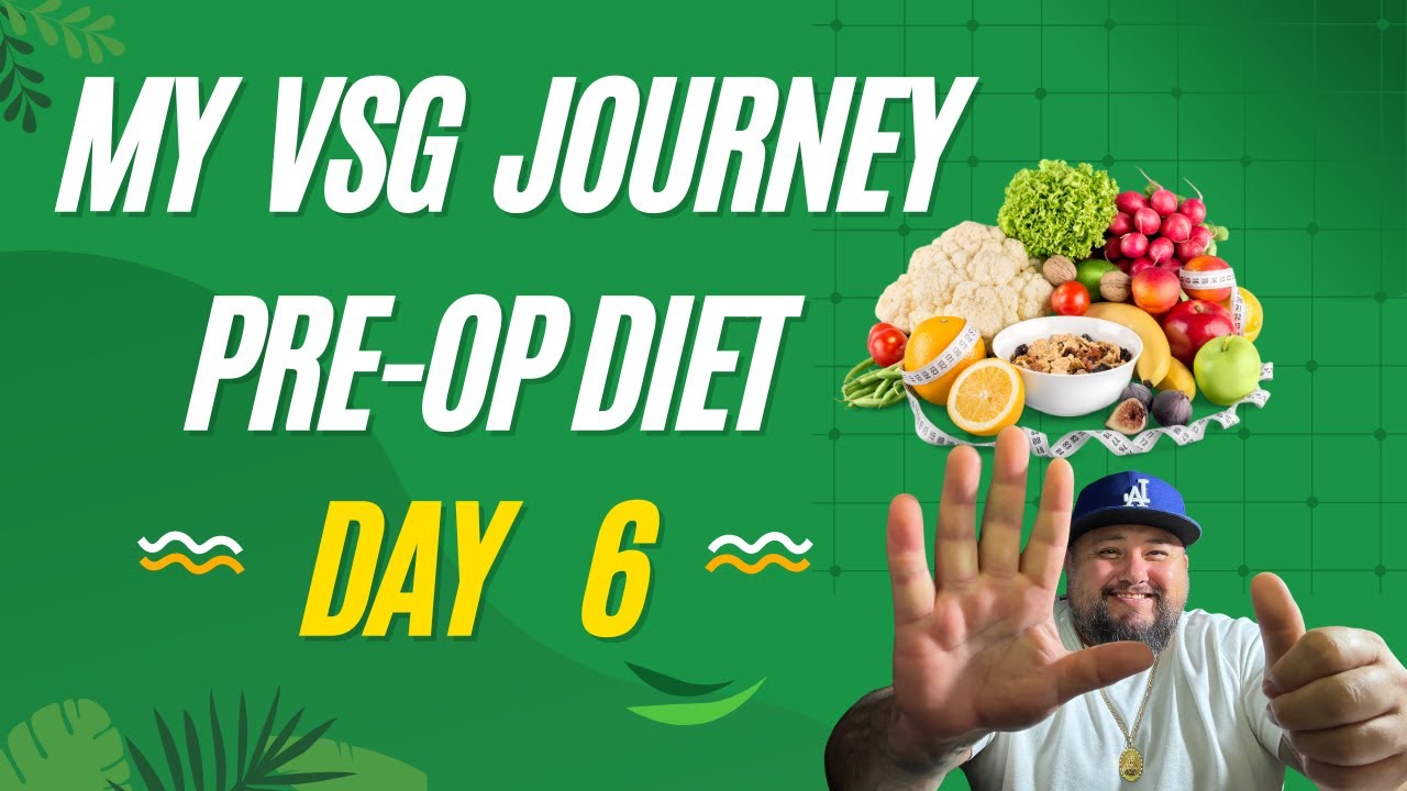 Vertical Sleeve Gastrectomy, VSG, Bariatric Surgery... Pre-op Diet… Day ...
