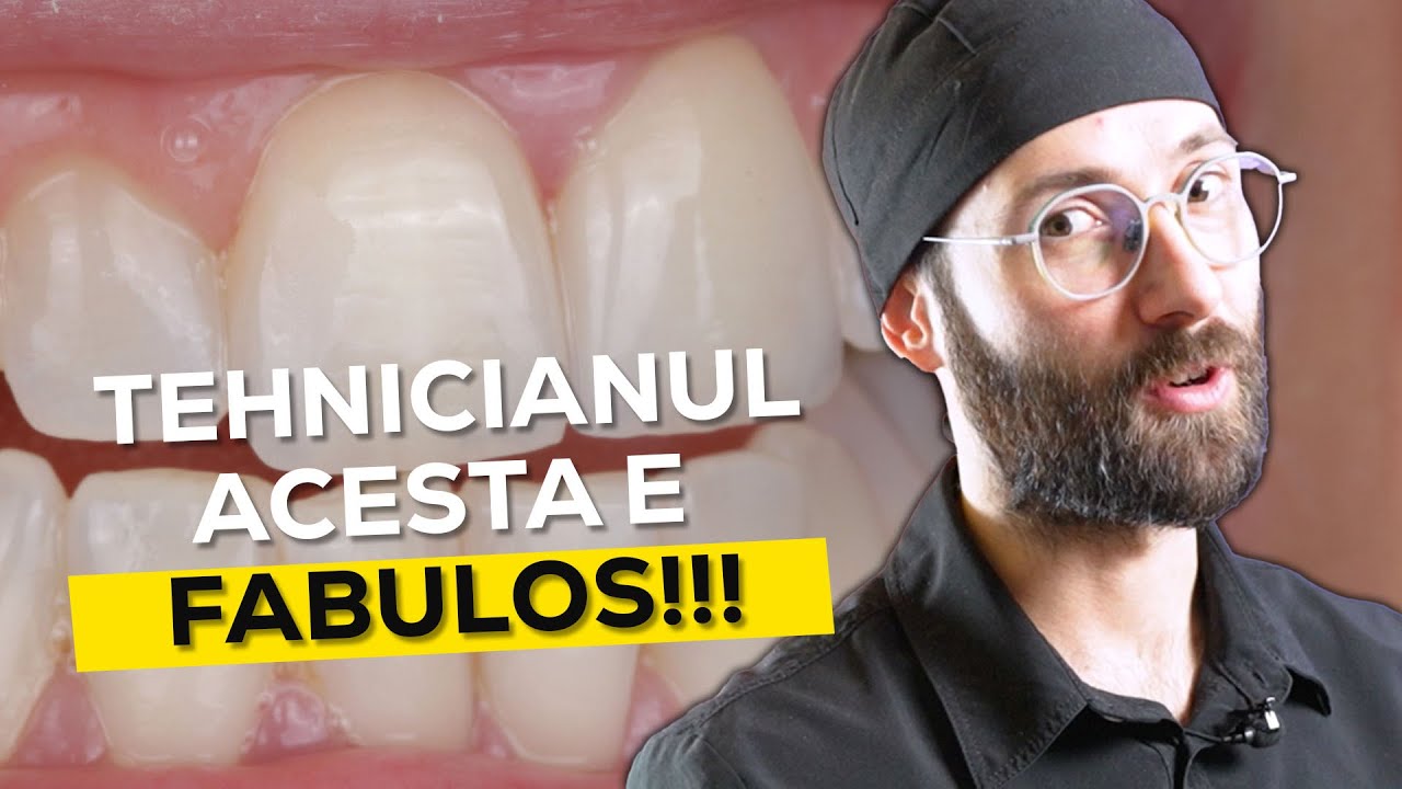 Fatete mai naturale NU EXISTA - YouTube