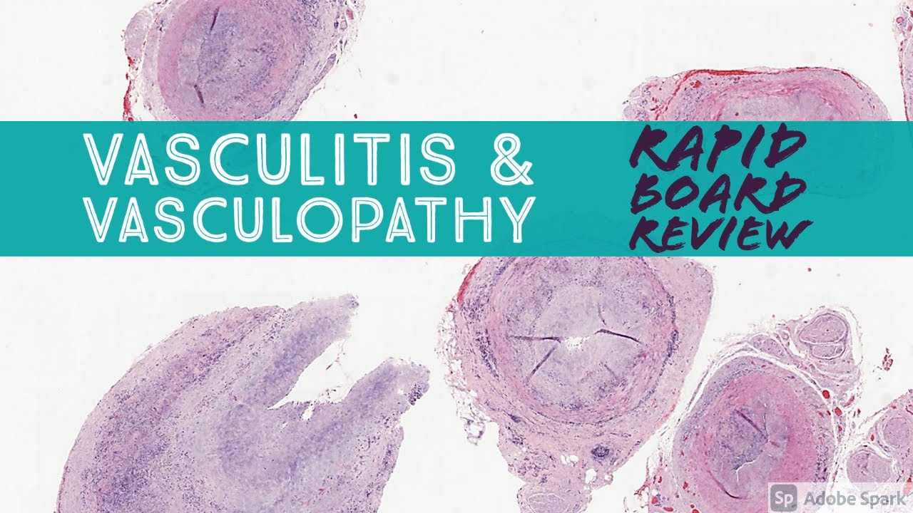 Dermpath Board Review: Vasculitis & Vasculopathy (Dermpath Dermatology ...