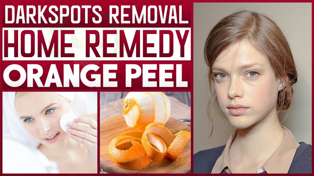 How To Remove Dark Spots | How To Clear Skin | Dark Spots On Face ...