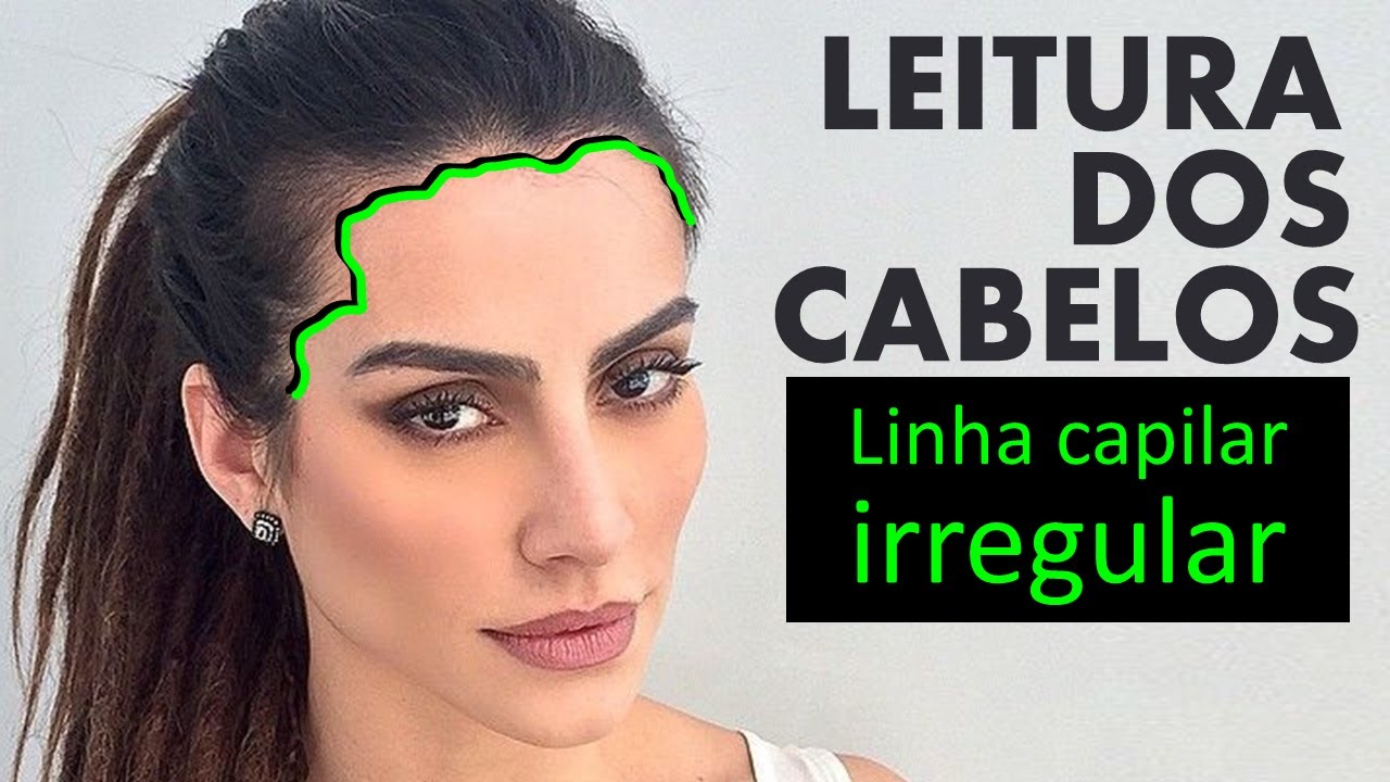 Fisiognomonia dos cabelos - Significado da Linha capilar irregular ...