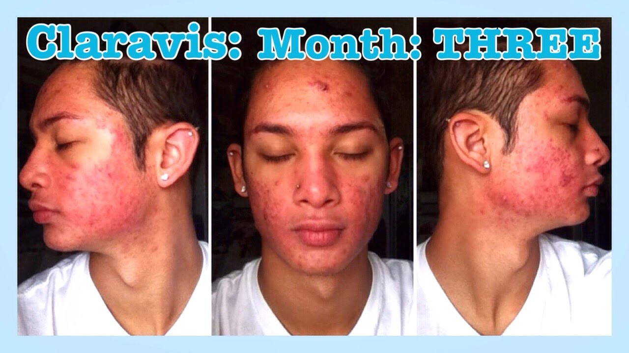 Claravis Month Three - YouTube