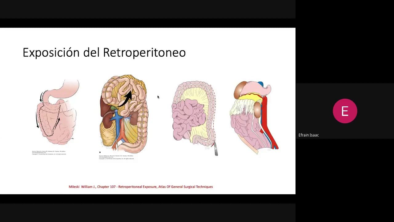 Abordaje trauma retroperitoneal - YouTube