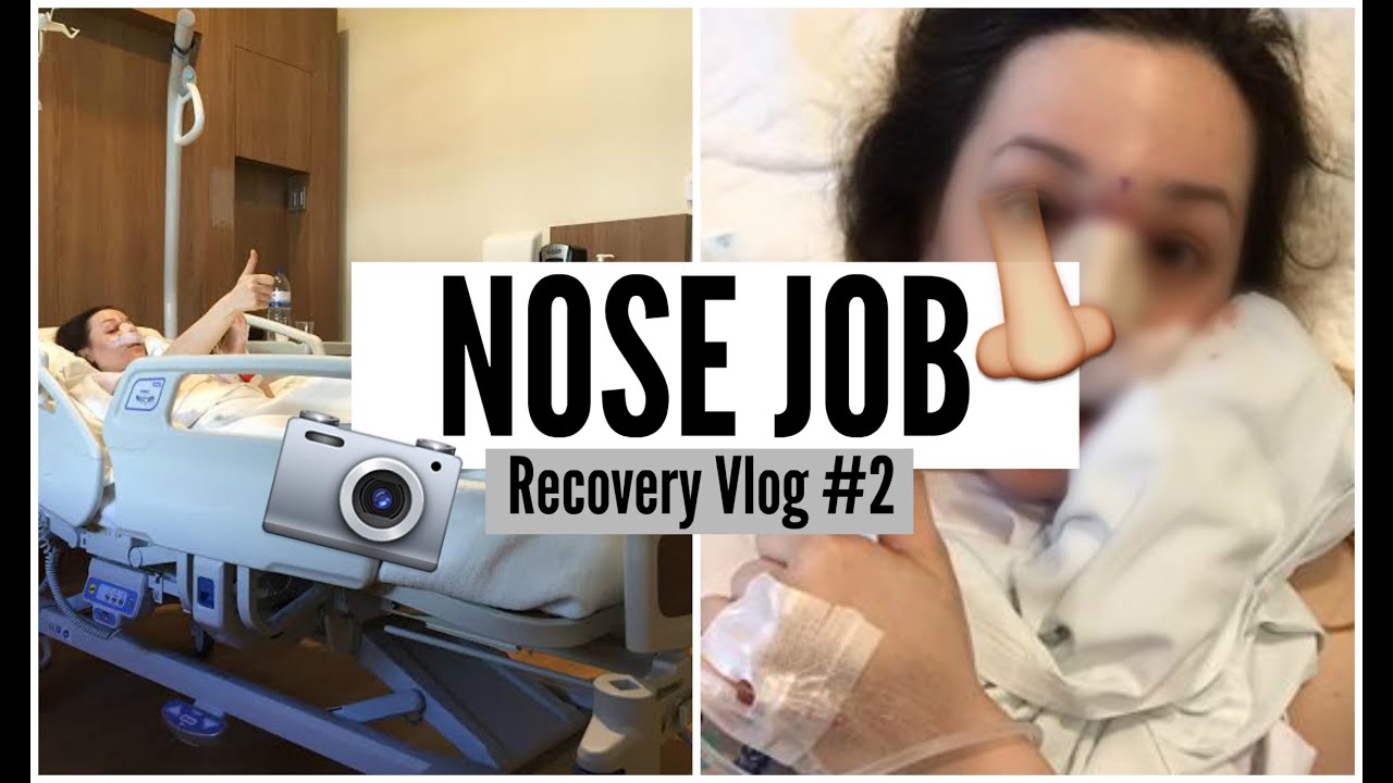 IT'S SURGERY DAY! ♡ Nose Job Recovery Vlog #2 - YouTube