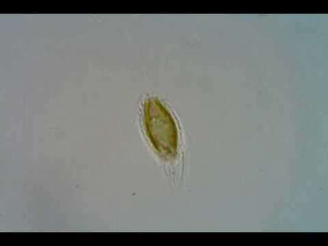 Mallomonas sp. - YouTube
