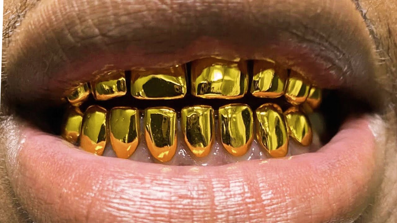 The Best Place to get Grillz and Caps in London! 18KGRILLZ - YouTube