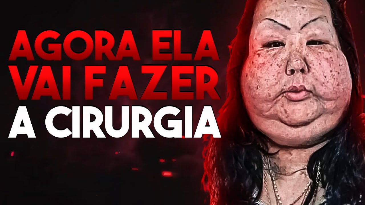 PARECE QUE FINALMENTE A JUJU DO PIX QUER FAZER A CIRURGIA NO ROSTO ...