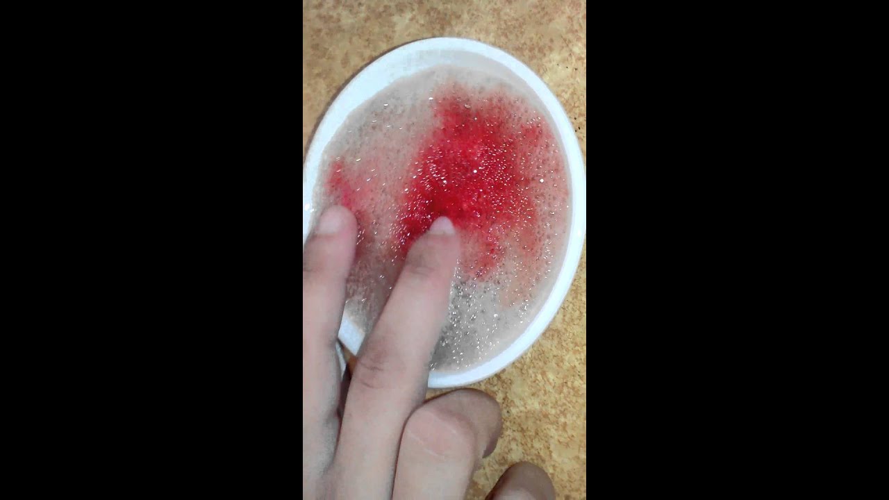 Cut my finger open. Put it in hydro peroxide - YouTube