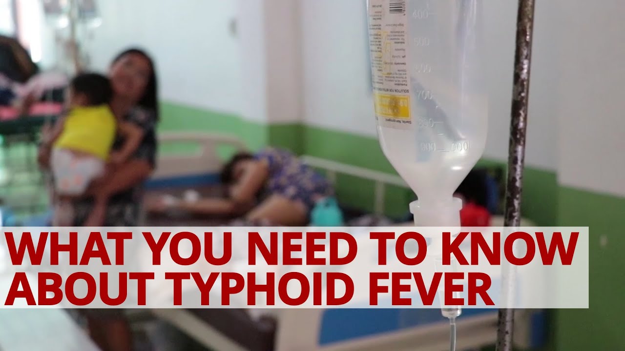 What You Need To Know About TYPHOID FEVER? - YouTube