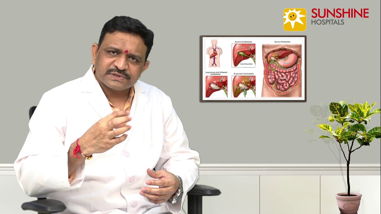Watch Dr. Vimalakar Reddy, Consultant Surgical Gastroenterologist, Talk ...