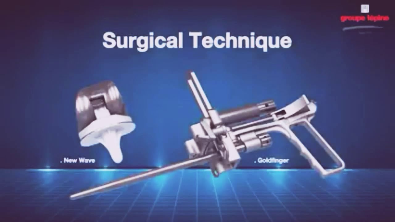 New wave Surgical Technique 3D Animation. - YouTube