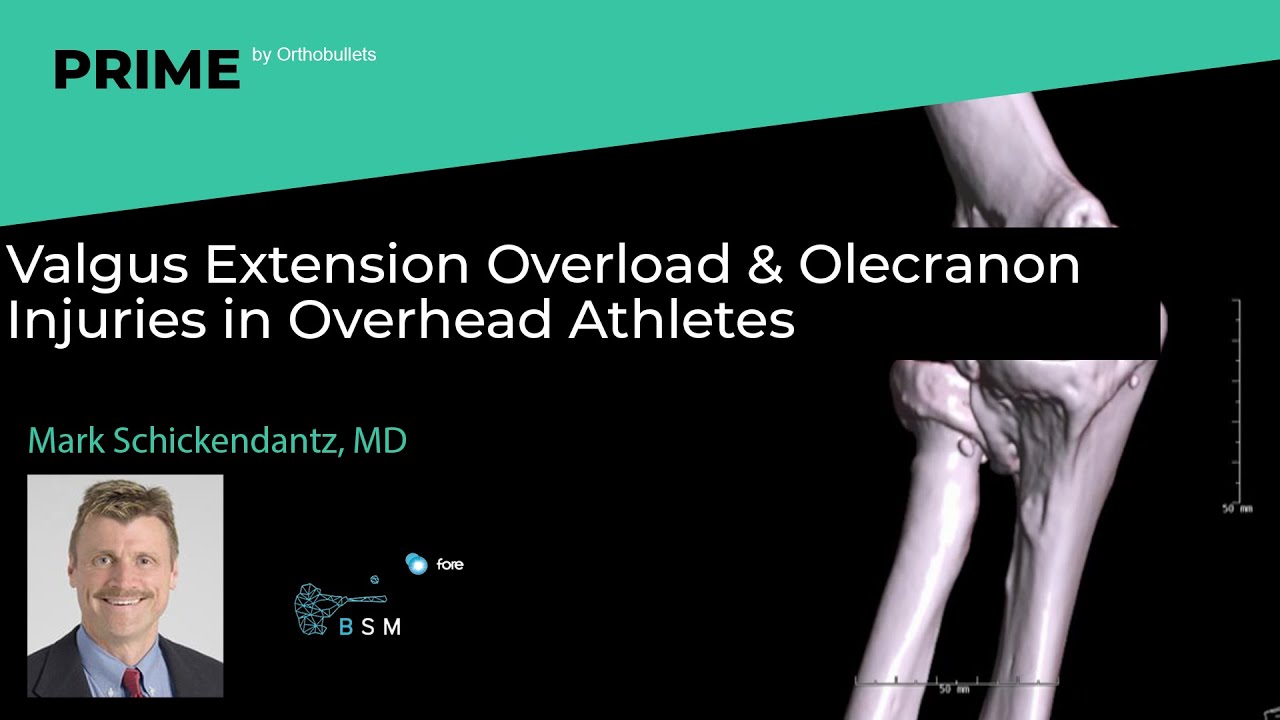 Valgus Extension Overload & Olecranon Injuries in Overhead Athletes ...