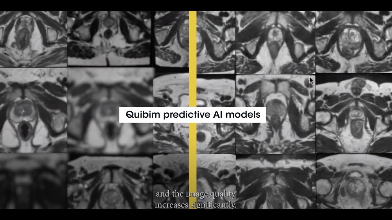 Data Harmonization, developing robust AI-driven predictive models - YouTube