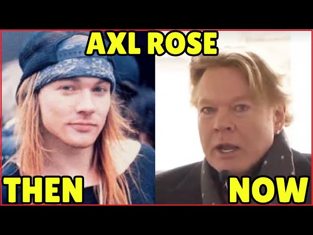 Axl Rose Before And After Axl Rose Voice Then And Now