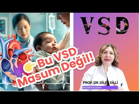 💔Ventriküler Septal Defekt (VSD): Ne zaman ameliyat gerekir⁉️   💔 VSD: When Is Surgery Required⁉️