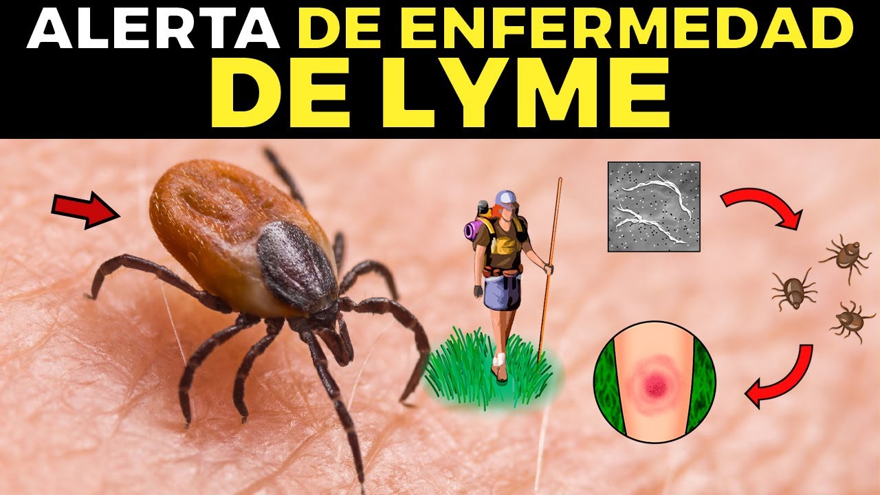 13 señales de que tienes enfermedad de Lyme - YouTube