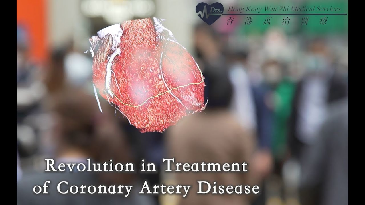 Dr. Jay Foon Lok KAY – Revolution in Treatment of Coronary Artery ...
