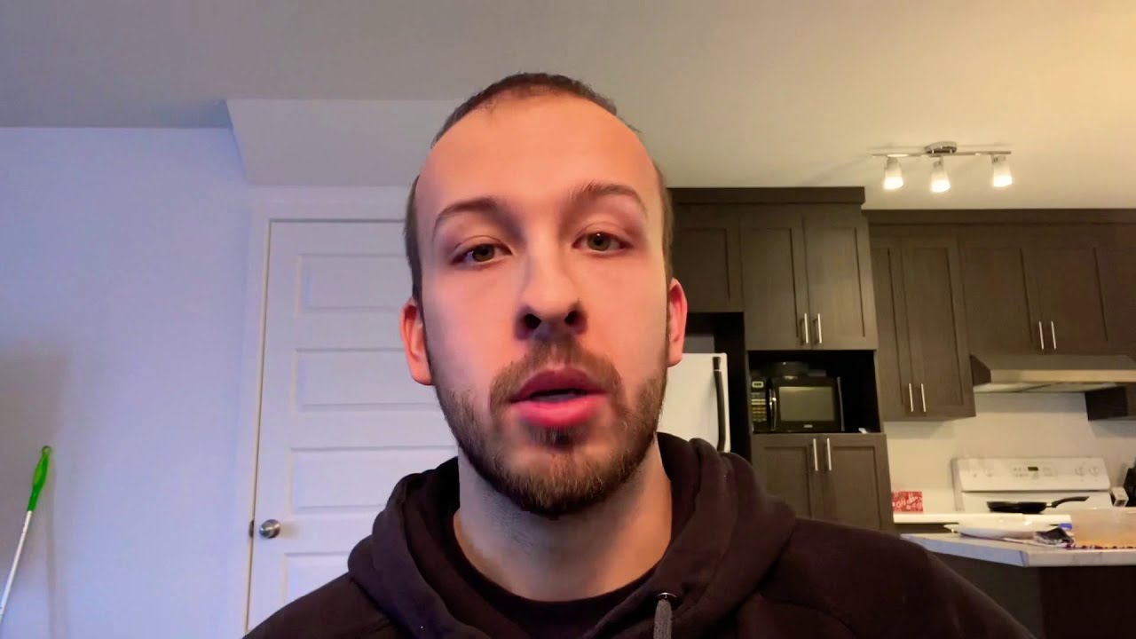 Hair transplant 3 month growth UPDATE @Hasson and Wong - YouTube