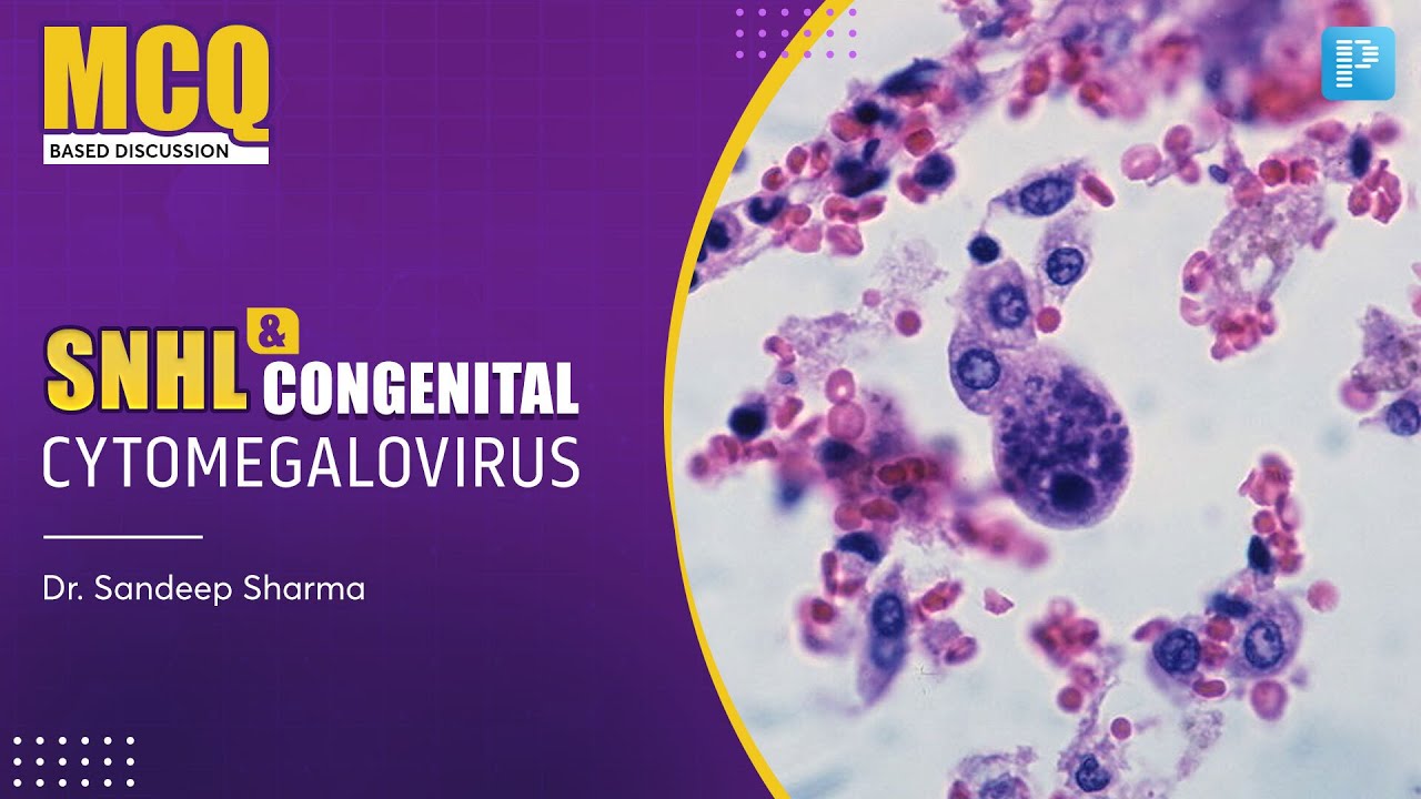 SNHL & Congenital Cytomegalovirus [General Pediatrics] - NEET SS MCQ ...