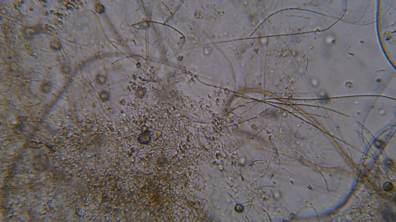 Rotaria Sp. - YouTube