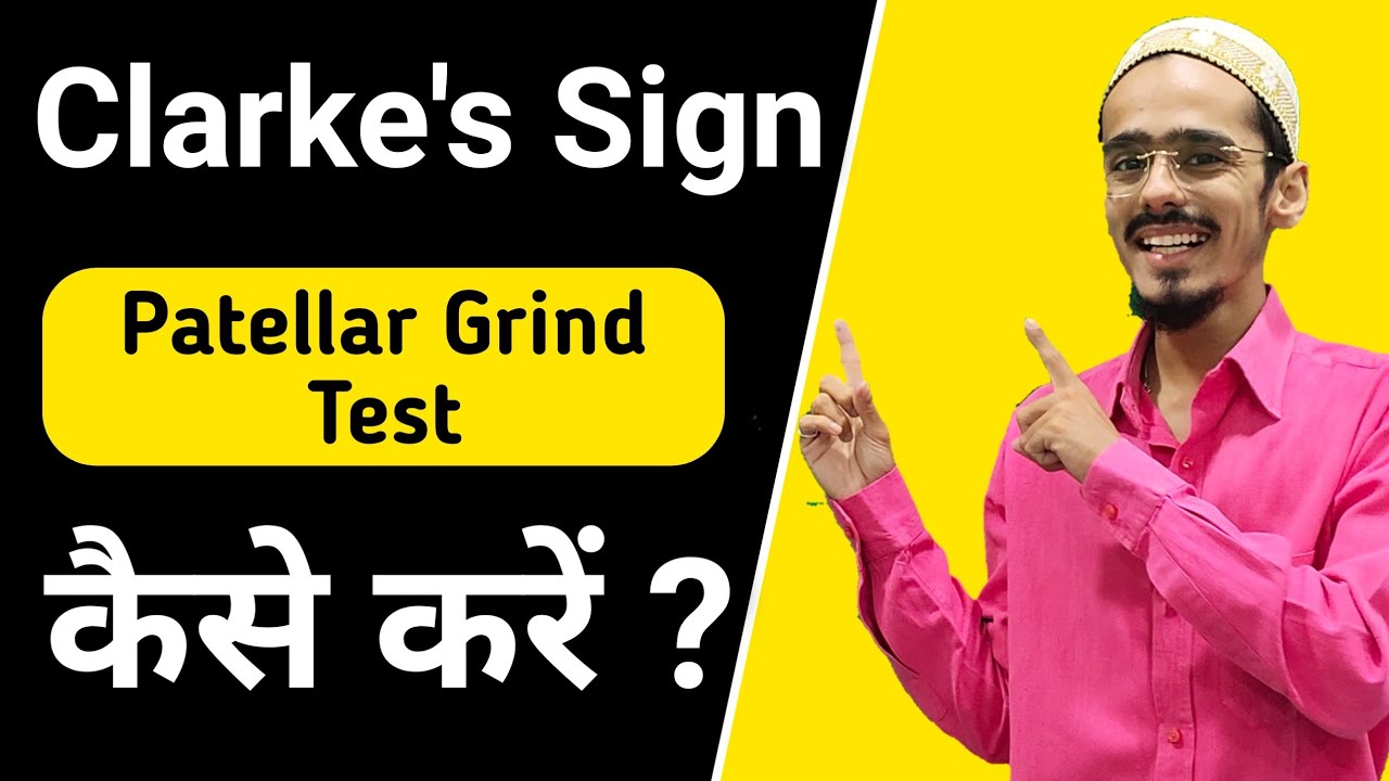 Clarke's sign | patellar grind test | patellofemoral pain ...