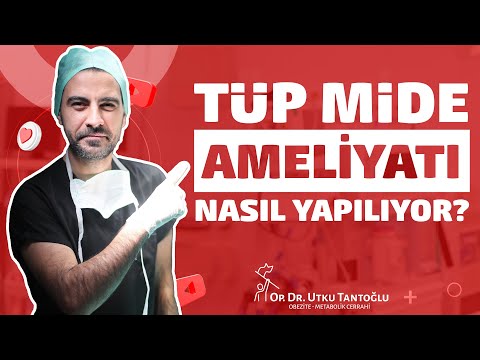 TÜP MİDE AMELİYATI NASIL YAPILIYOR ? | Adım Adım Obezite Ameliyatı