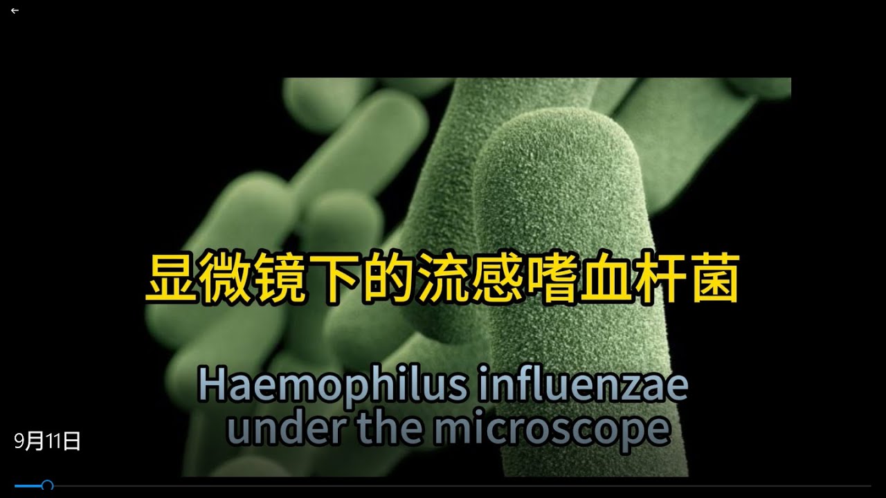 Haemophilus influenzae under the microscope - YouTube