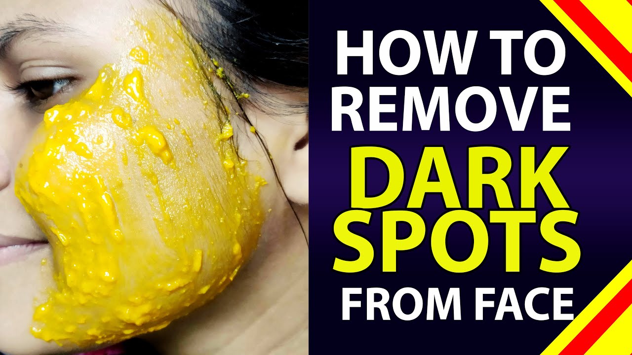 How to Remove Dark Spots from Face Naturally | Remove Dark Spots, Black ...