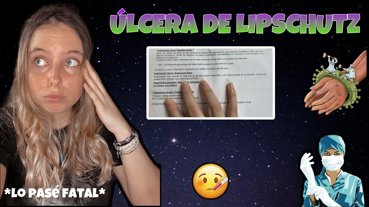úlcera De Lipschütz Imagens - RETOEDU