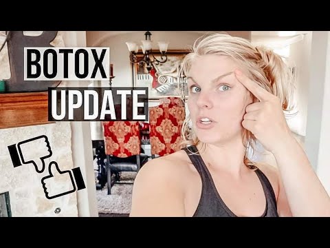 BOTOX UPDATE ON DAY 4 | DAY IN THE LIFE - YouTube