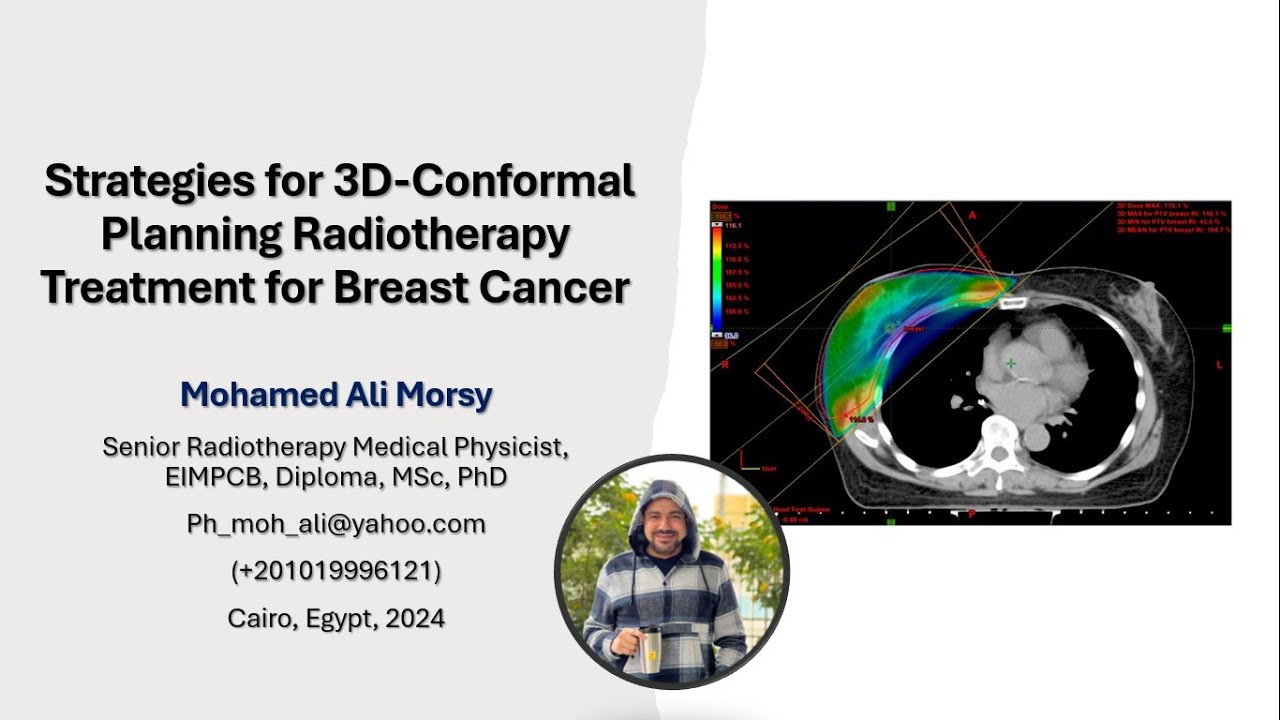 Strategies for 3D Conformal Planning Radiotherapy Treatment for Breast ...
