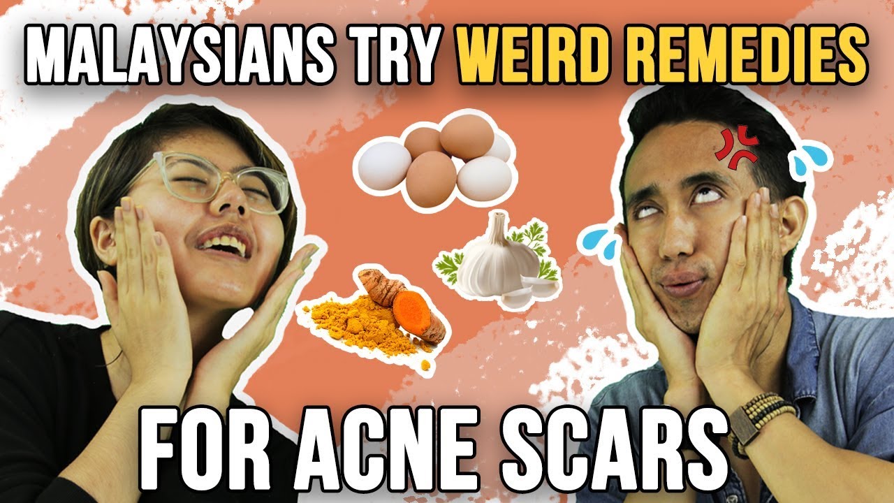 Malaysians Try Weird Remedies For Acne Scars - YouTube