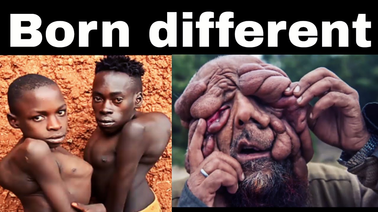 people that you won't believe exist - Born different ...