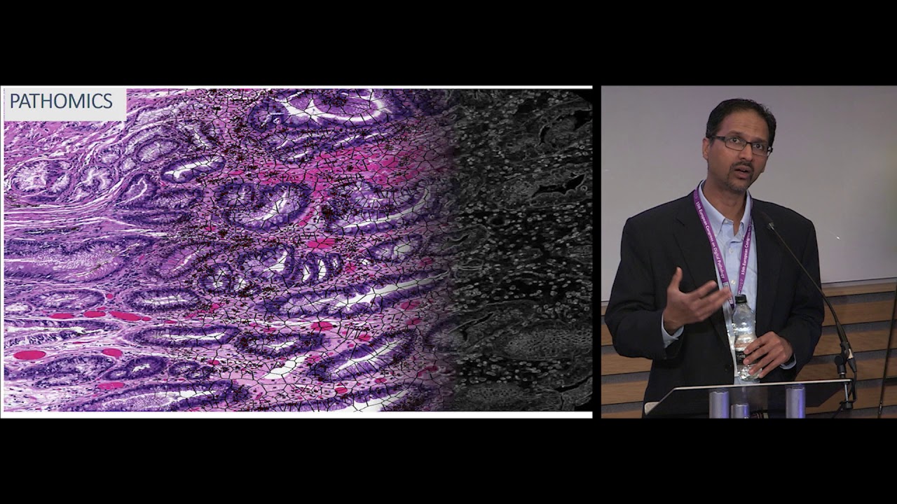 ECDP 2019 | Computational Pathology as a Companion Diagnostic ...
