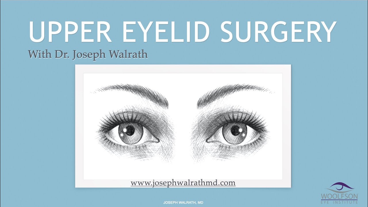 Upper Eyelid Basics - YouTube