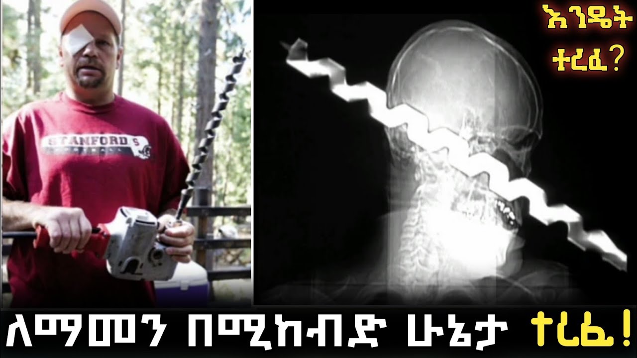 ከማይተረፍበት ክስተት ለማመን በሚከብድ ሁኔታ ተረፈ/amazing story/unbelievable /j8 top ...