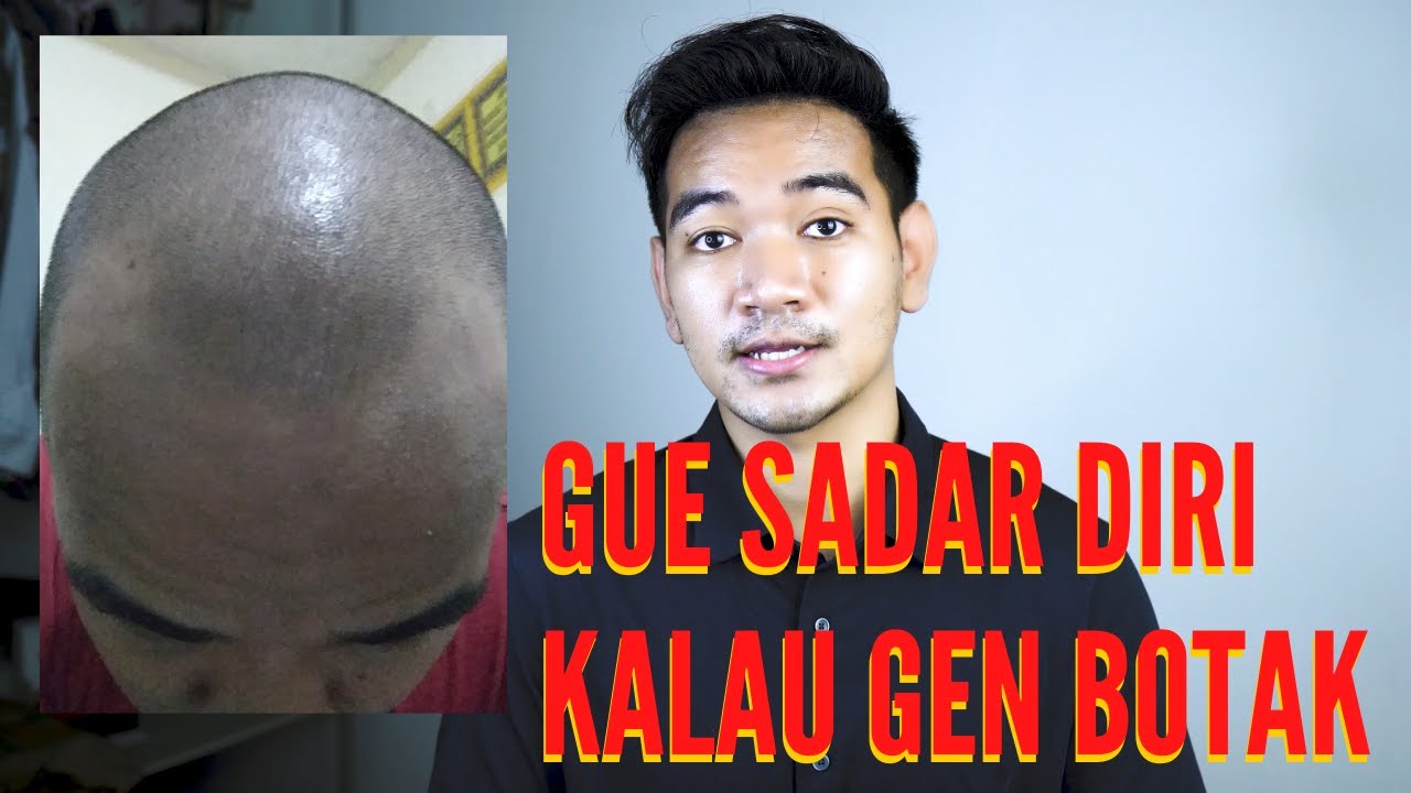 4 HAL YANG HARUS DITERIMA KALAU GEN BOTAK - YouTube